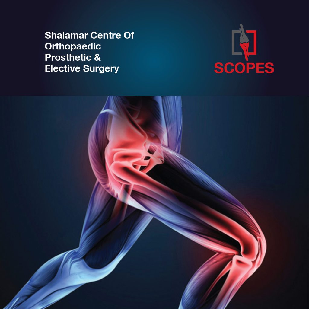 Orthopaedic, Prosthetic & Elective Surgery | SCOPES - Shalamar Hospital ...
