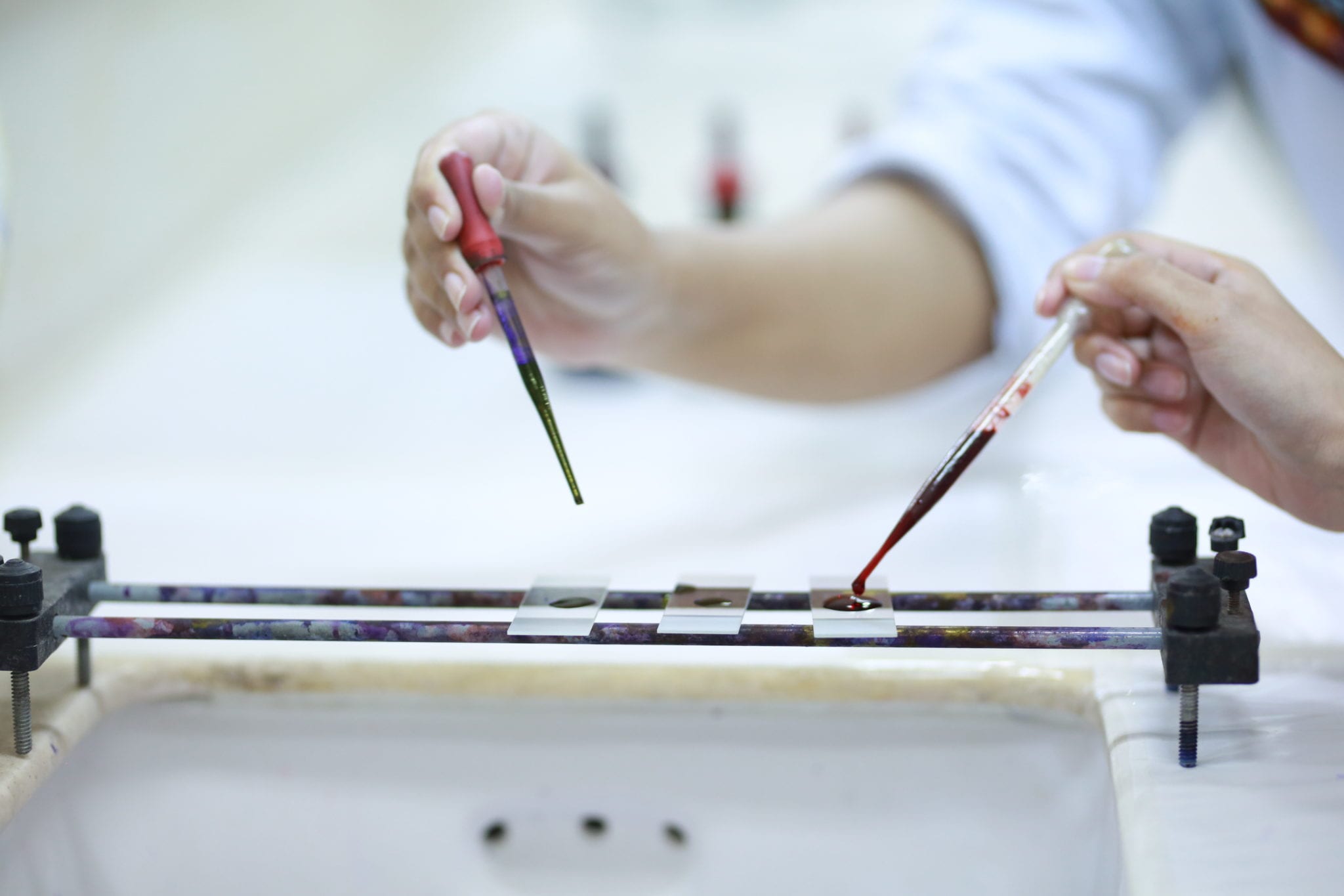 Pathology Department & Laboratory - Shalamar Hospital Lahore